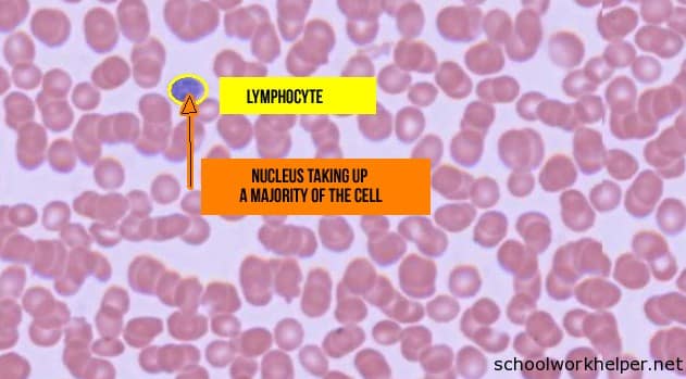 lymphocyte-slide-labelled-histology | SchoolWorkHelper