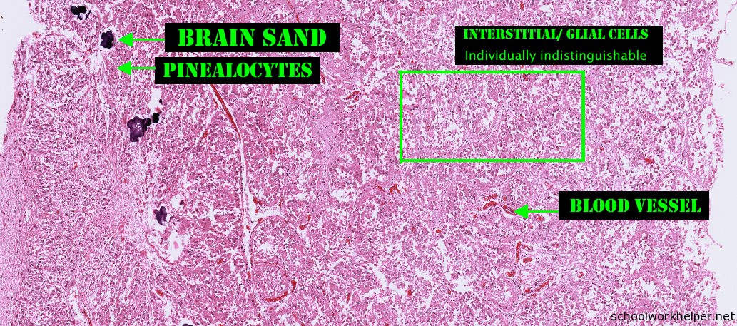 pineal-gland-slide-labelled-histology | SchoolWorkHelper pineal-gland-slide-labelled-histology | SchoolWorkHelper